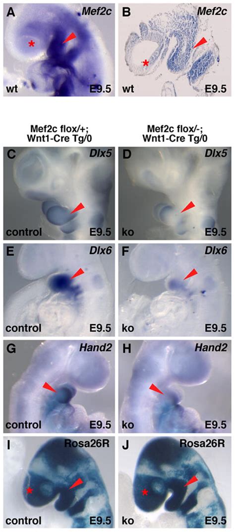The Transcription Factor Mef2c Is Required For Craniofacial Development