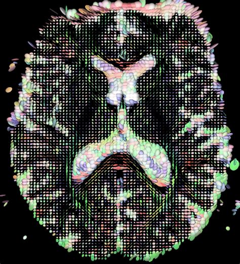 Left 2d Slice Extracted From A 3d Dt Mri Data Set 128 × 128 Voxels Download Scientific