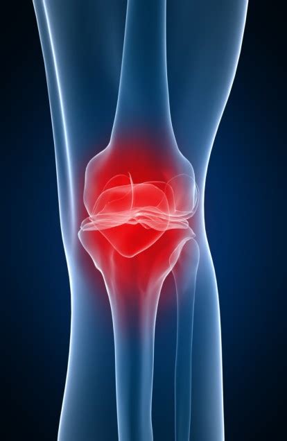 Project Body Smart Do Your Joints A Favor
