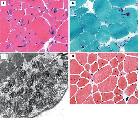 Skeletal Muscle And Peripheral Nerve Disorders Clinical Tree