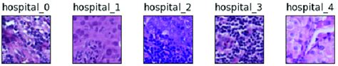 Sample Histopathology Images From Each Hospital Within The Wilds Download Scientific Diagram