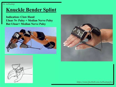 Orthopedic Splints And Casts Subhadeep Pgmodulespptx
