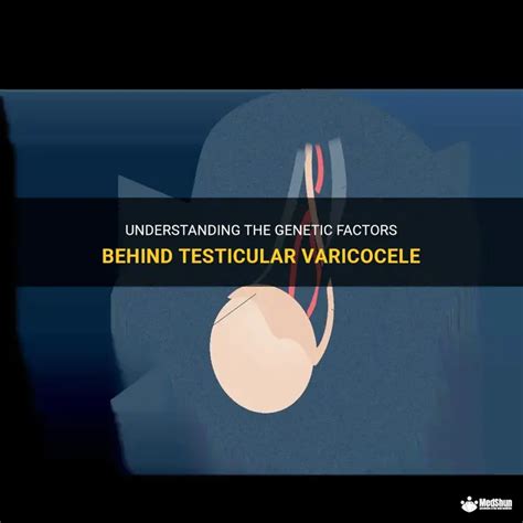 Understanding The Genetic Factors Behind Testicular Varicocele Medshun