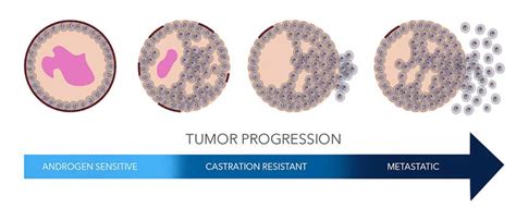Prostate Cancer Tocris Bioscience