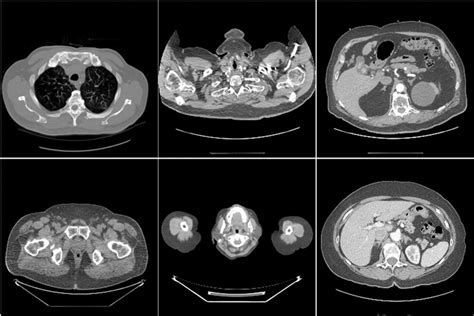 Examples From Our Normal Dose Ct Image Dataset Download Scientific