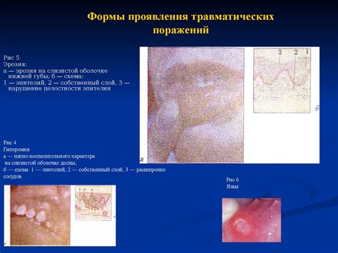 Классификация заболеваний слизистой оболочки полости рта презентация онлайн