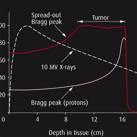 Lymph Node Location For Breast Cancer An Anterolateral View Of The Download Scientific Diagram