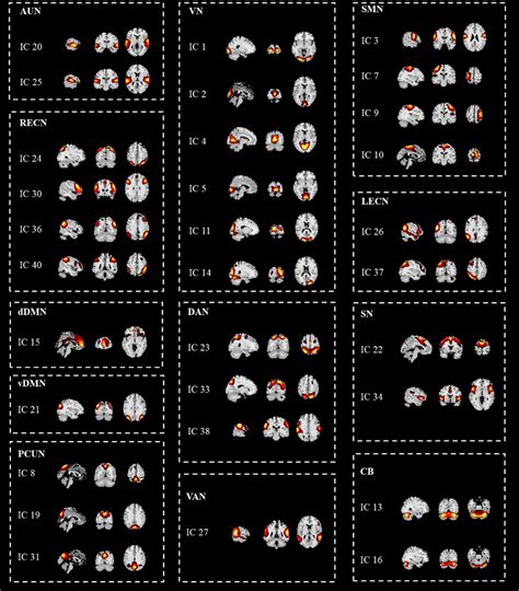 Spatial Maps Of The 31 Intrinsic Connectivity Networks Icns The 31