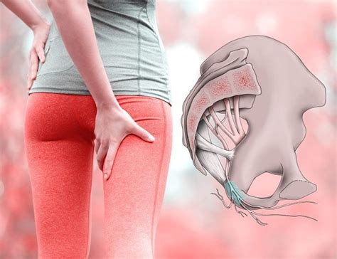 The Best 10 Pudendal Neuralgia Exercises To Your Well Being