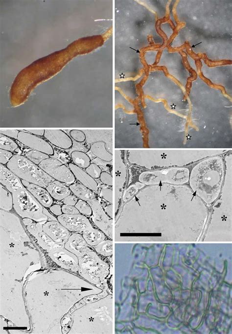 Ectomycorrhizal Fungi Microscope Mycorrhizal Associations