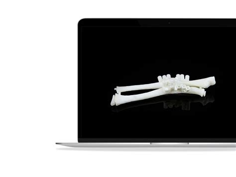 Webinar 3d Planning And Personalized Guides In Corrective Osteotomies