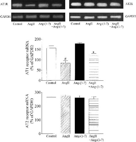 Representative Reverse Transcriptase Polymerase Chain Reaction Rt Pcr