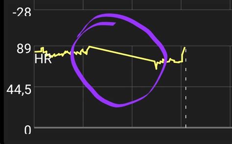 Minor Heart Rate Graph Missing Data · Issue 2584 · Nightscout
