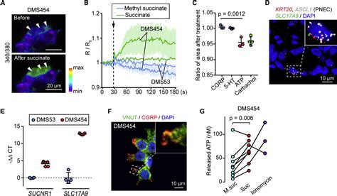 Pulmonary Neuroendocrine Cells Sense Succinate To Stimulate