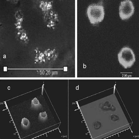 Particle Size Distribution Profiles For Micronized Dexamethasone