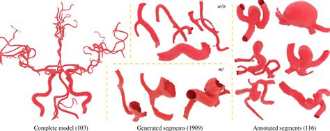 Intra 3d Intracranial Aneurysm Dataset For Deep Learning