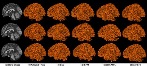 the rendering brain surfaces of segmentation results from sagittal