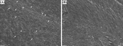 Optimized Decellularization Protocol Including α Gal Epitope Reduction For Fabrication Of An