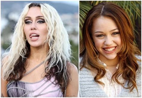 Miley Cyrus Veneers Miley Cyrus Veneers Miley Emilyjonas Flickr