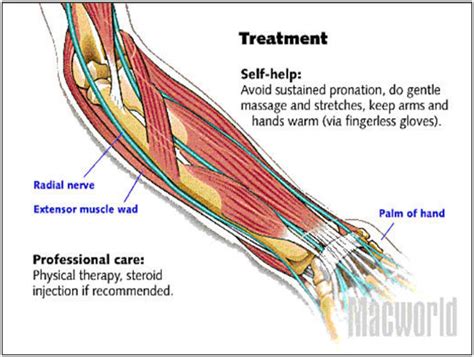 Extensor Tendon Mcp Joint
