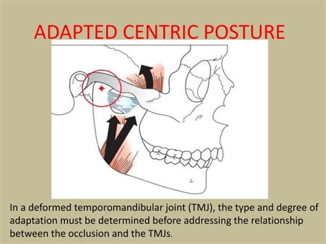 Centric Relation Pptx