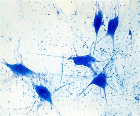 Innovative Gene Therapy Programme Paves The Way For New Treatments For Neurodegenerative