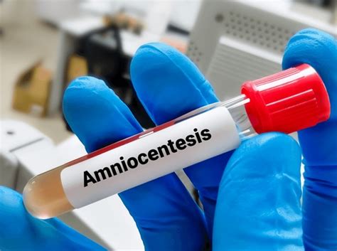 Hundred Amniocentesis Royalty Free Images Stock Photos Pictures Shutterstock
