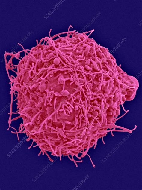 Chinese Hamster Ovary Cell Sem Stock Image C031 9942 Science Photo Library