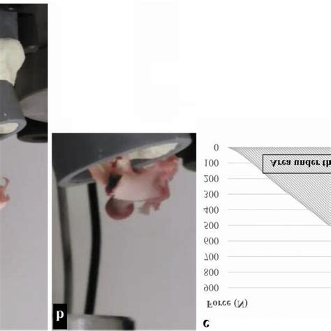 Setup Of The Femoral Head Compression Test The Compression Direction