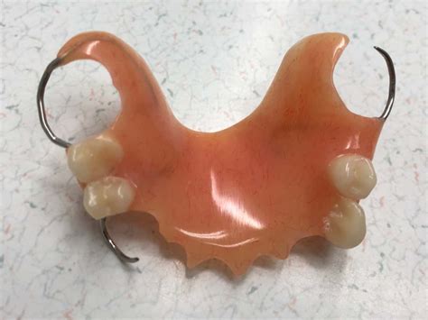 Partial Castacrylic Dentures Flippers And Custom Options Grantham