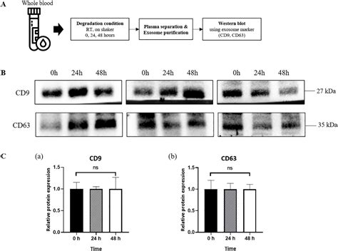 Figure From Characterization Of Exosomes And Exosomal RNAs Isolated From Post Mortem Body