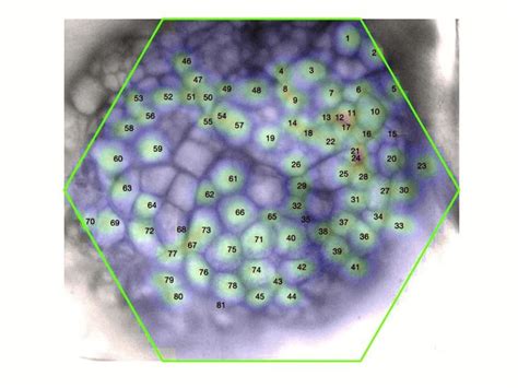 Optical Imaging With A 464 Element Photodiode Array Helps Tease Out The