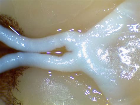 Mouse Optic Nerve Instance Segmentation Model By Research