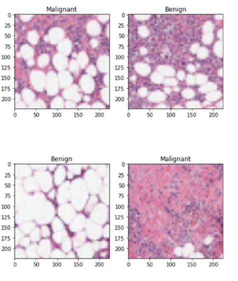 Example Breast Histopathology Images Download Scientific Diagram