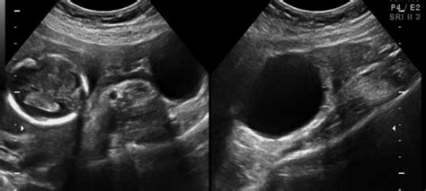 Adnex Vs O Rads Novice Operator Algorithm Comparison
