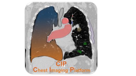 Chest Imaging Platform Cip