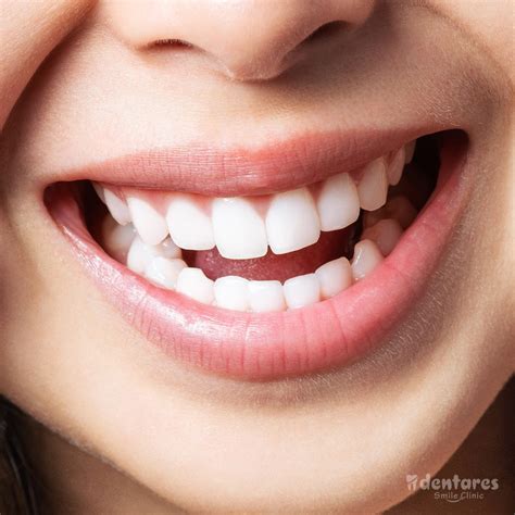 Getting New Teeth In Turkey Dentares Dental Centre Turkey