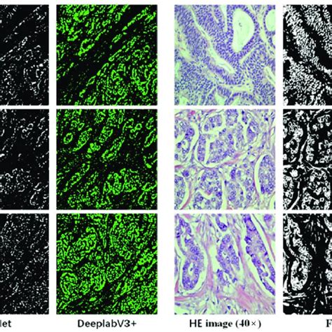 nuclei segmentation results using fiji watershed unet and