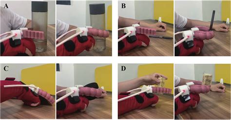A Flexible Wearable Supernumerary Robotic Limb For Chronic Stroke Patients