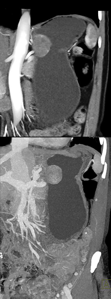 Gastrointestinal Learning Modules Ct Scanning
