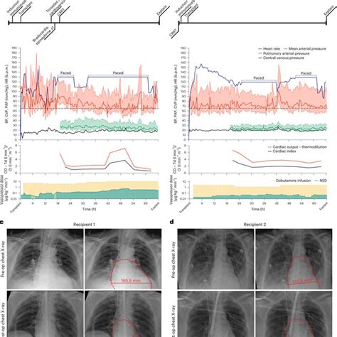 Study Timelines And Cardiac And Systemic Hemodynamic Measurements Ab