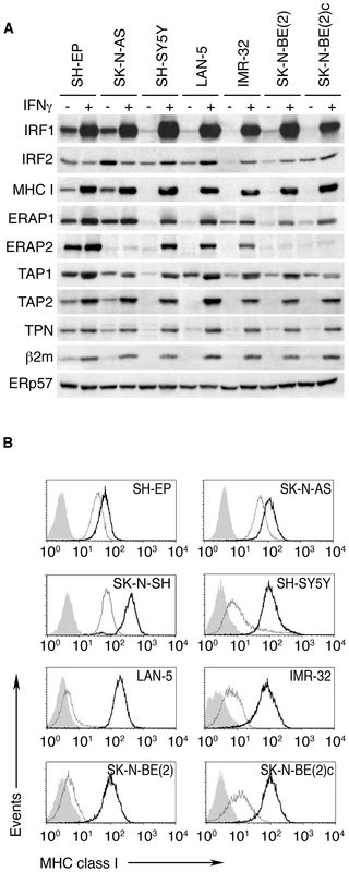 Irf1 And Nf Kb Restore Mhc Class I Restricted Tumor Antigen Processing