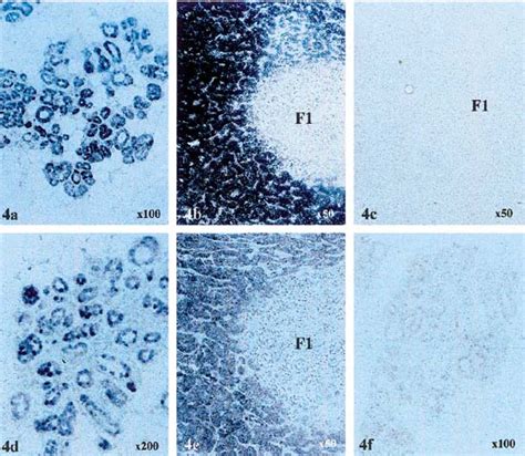 Nonradioactive In Situ Hybridization For C Myc A C And E2fl D F