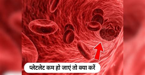 Dengue Fever Alert Tips To Increase Platelets Count By Giloy Nariyal Paani Coconut Water Instant