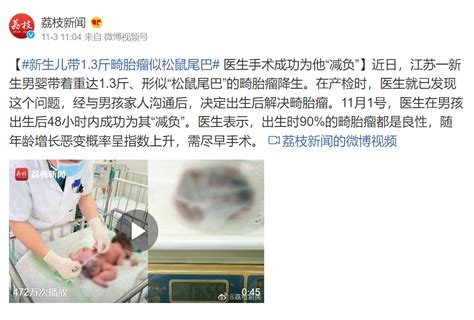 宝宝出生自带「松鼠尾巴」？医生：「恶变之前尽早切除！」医学界 助力医生临床决策和职业成长