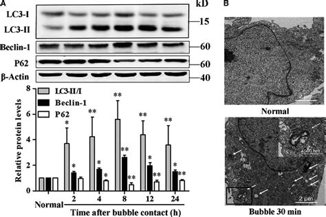 Autophagy In Huvecs Was Induced By Bubble Contact A Lc3‐ii I Ratio Download Scientific
