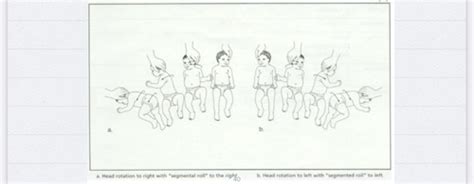 Lecture 1 Postural Reflexes Flashcards Quizlet