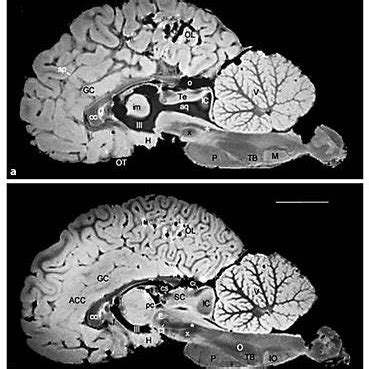 Basal Aspect Of Dwarf Sperm Whale Brain Ks9303b With Meninges Largely