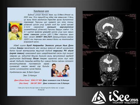 Тархины гаж хөгжилтэй нь тогтоогдож Энэтхэгт эмчлүүлэх шаардлагатай болсон Б Мөнх Итгэл хүүгийн
