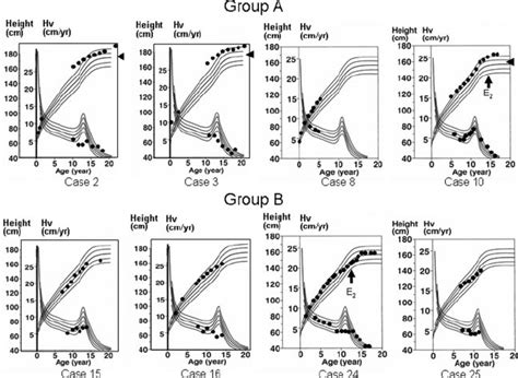Growth Charts Of Eight Cases Plotted On The Sex Matched Longitudinal Download Scientific